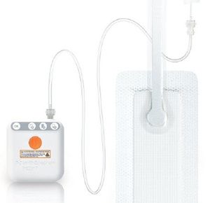 Shop Best Portable Wound VAC Machines, VAC dressings & more | SMITH ...