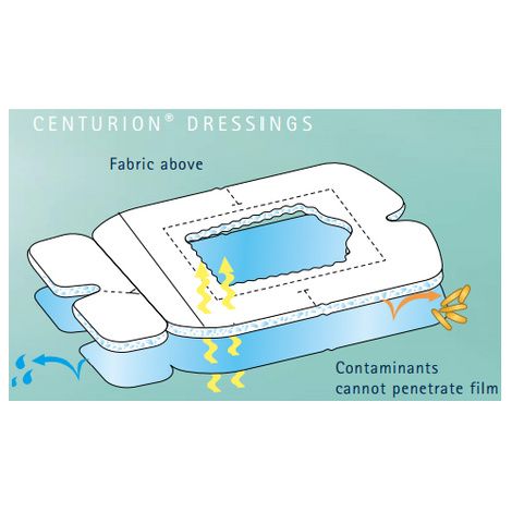 Order Sorbaview 2000 Window Dressing | Catheter/IV Dressings