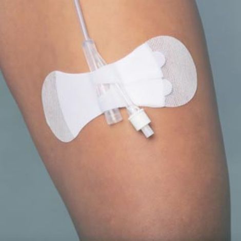 Tidi Grip-Lok Foley Securement Device