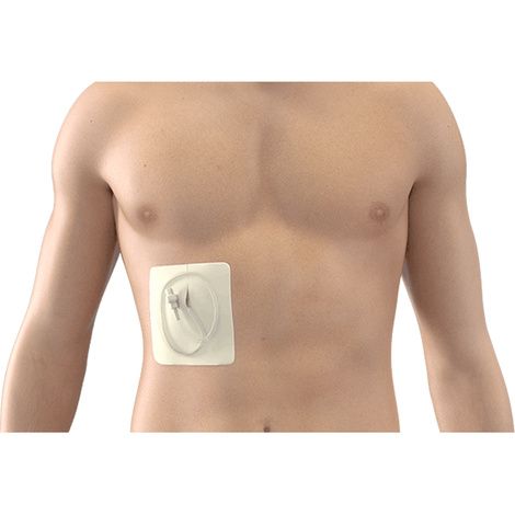 Buy Pleural Catheter System I Pleurx Drainage Kit