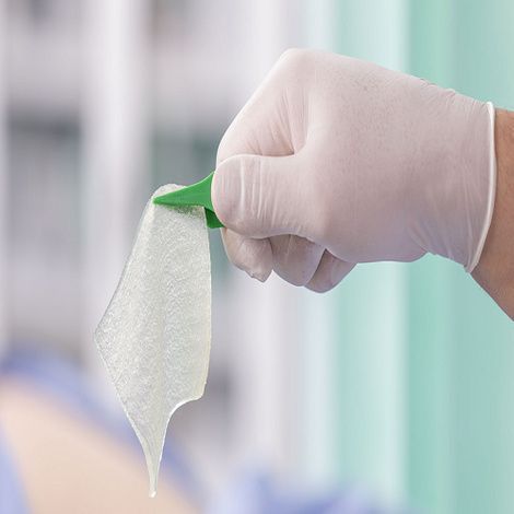 Molnlycke Exufiber Gelling Fiber Dressing